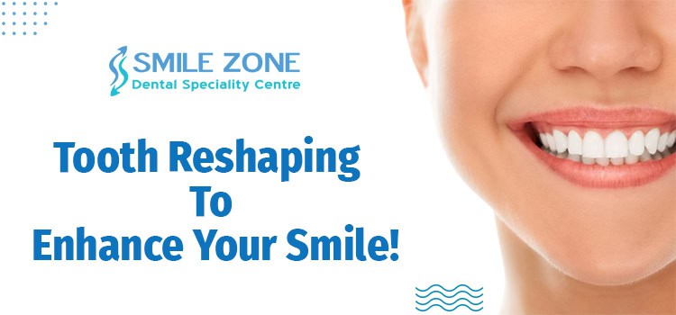 What Is A Tooth Reshaping Procedure, And Why Should You Undergo One?