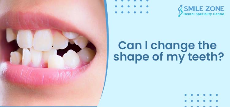 Teeth Reshaping Treatment Which Teeth Are Possible To Reshape 