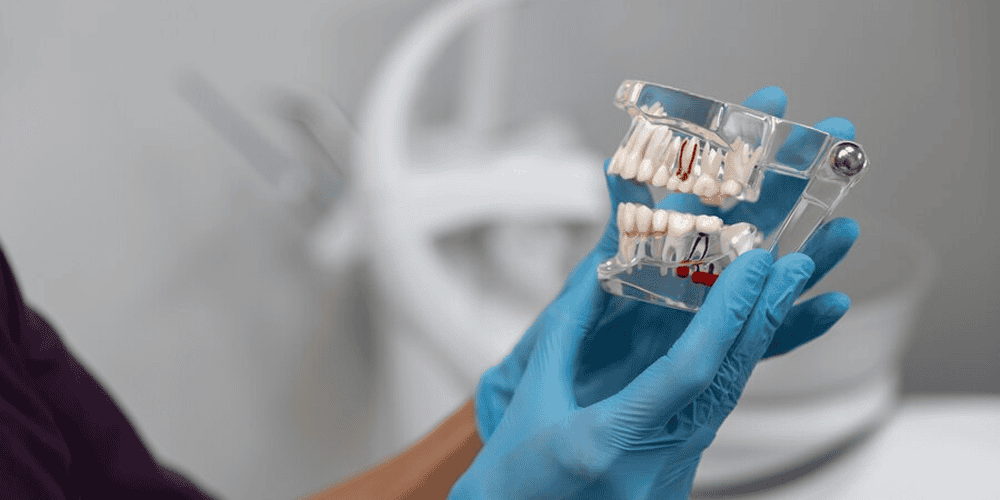 Cost of Wisdom Tooth Impaction & Extraction in Whitefield, Bangalore ...
